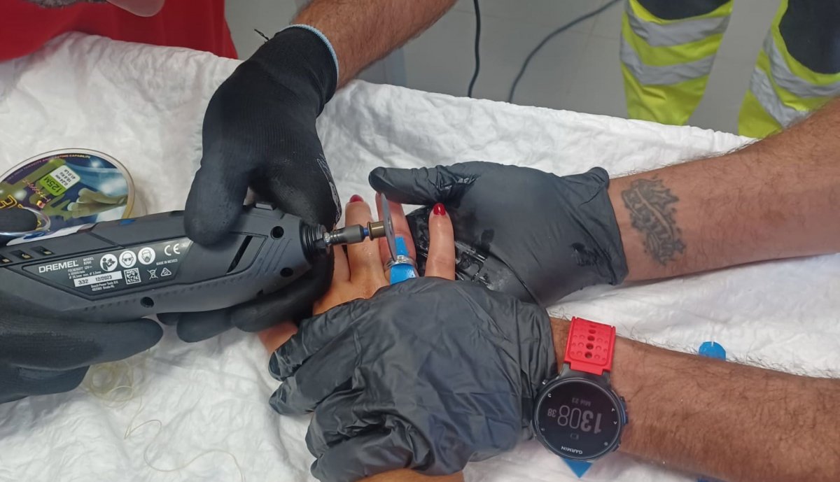 Firefighters remove a ring stuck on a woman's finger in Playa Blanca